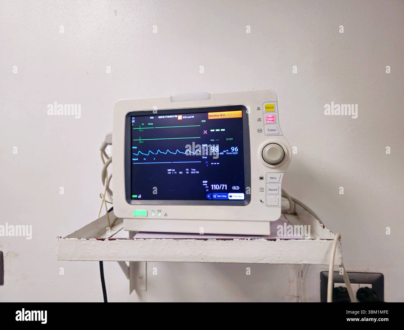 Vital signs data medical monitor for measurement of important vital ...