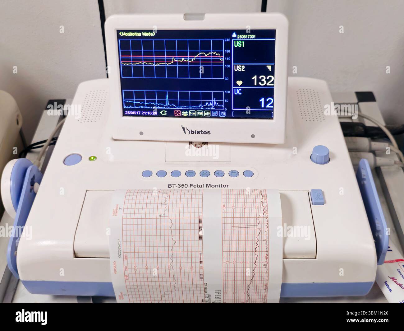 Cairo, Egypt, June 17 2025: Cardiotocography device placed on mother's ...