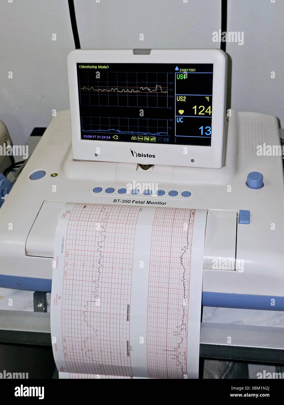 Cairo, Egypt, June 17 2025: Cardiotocography device placed on mother's ...