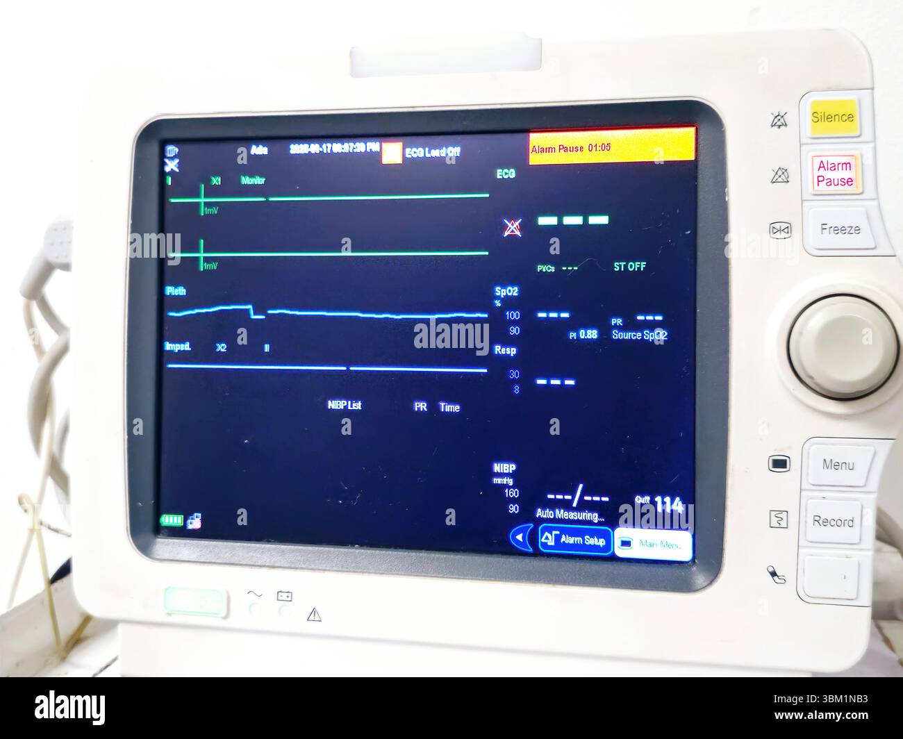 Vital signs data medical monitor for measurement of important vital ...