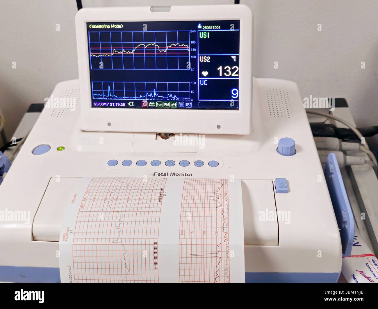 Cardiotocography device placed on mother's abdomen recording the fetal ...