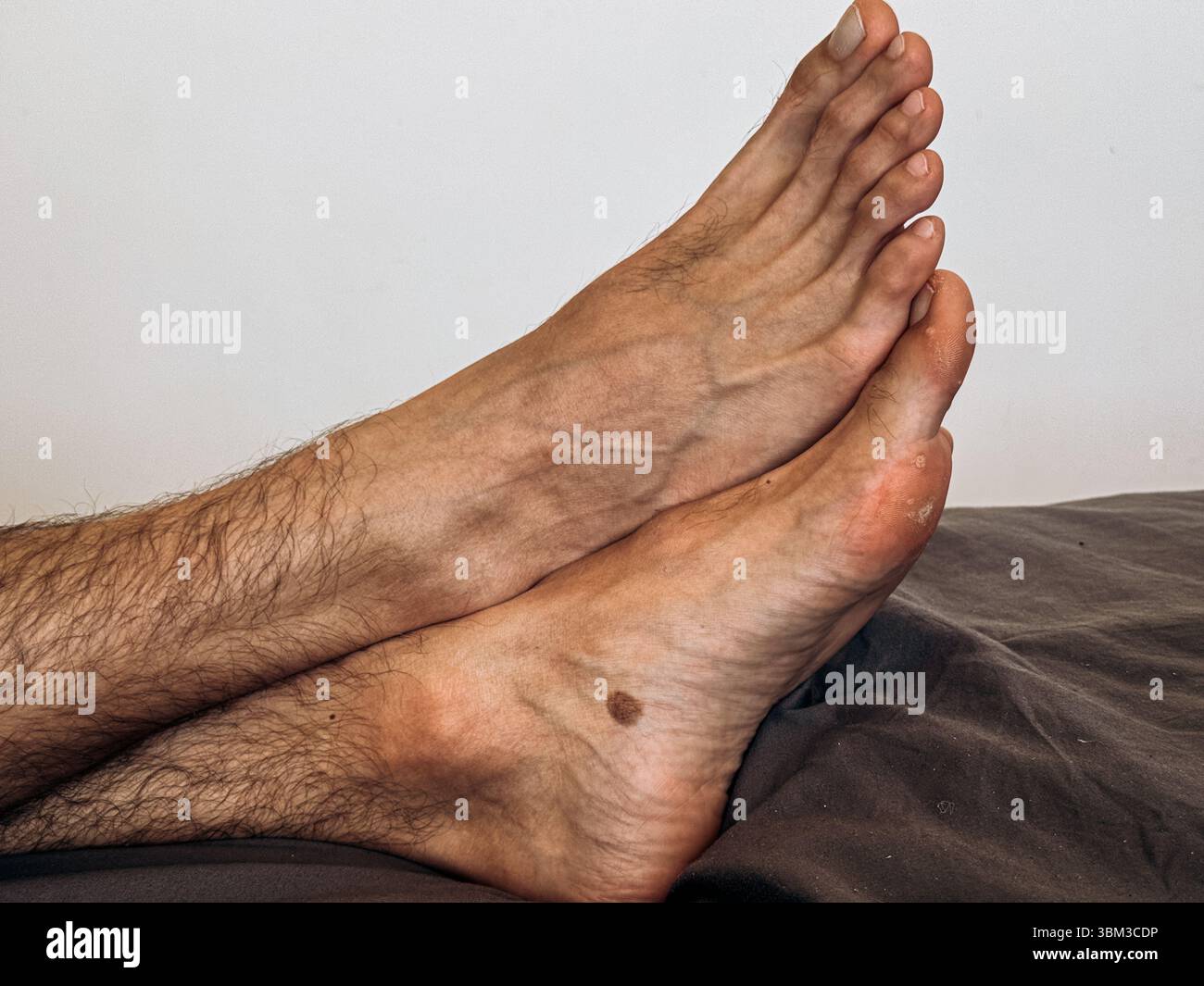 Male feet with visible mole and skin imperfections resting on dark ...