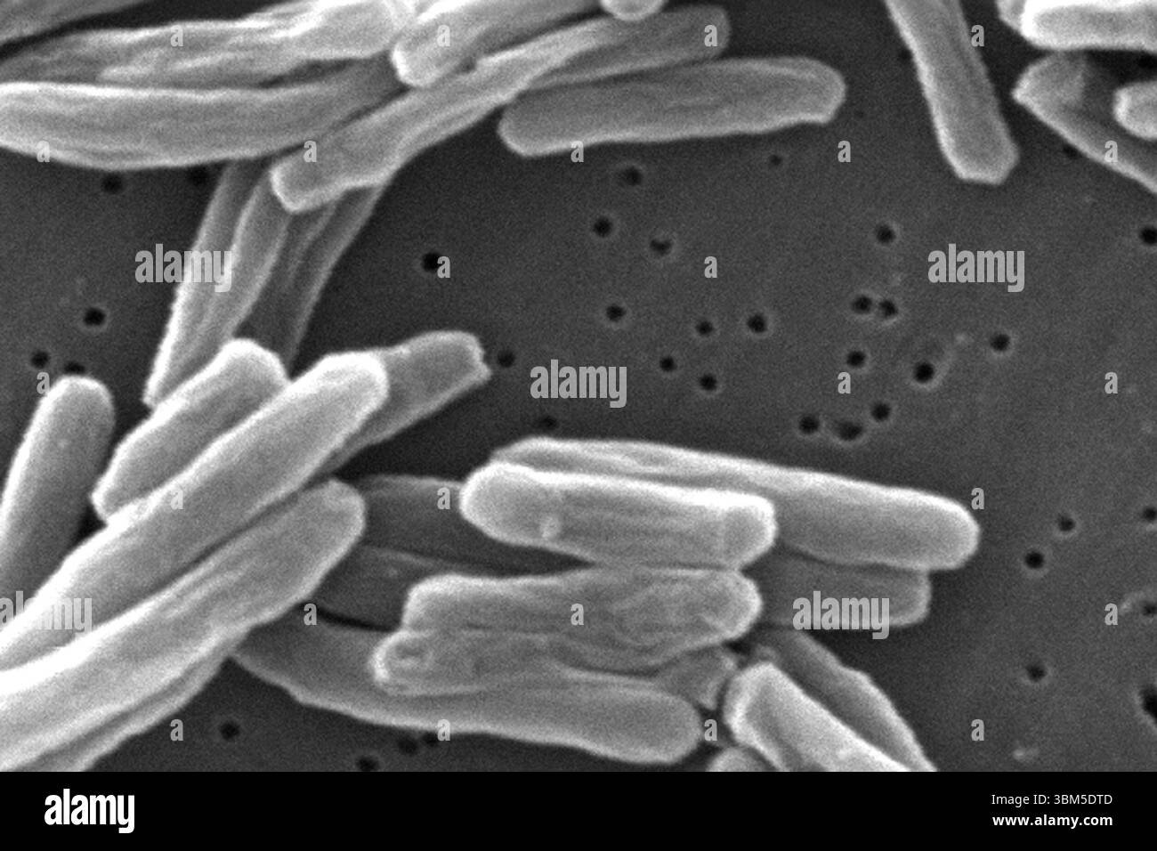 FILE - This 2006 electron microscope image provided by the Centers for ...