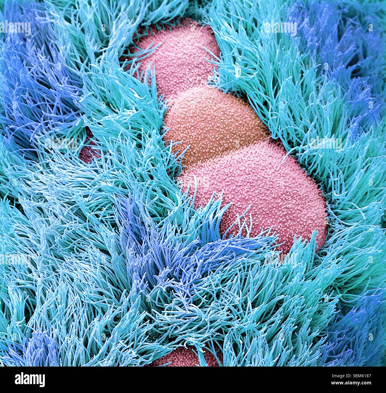 HAE organoid. Coloured scanning electron micrograph (SEM). HAE ...