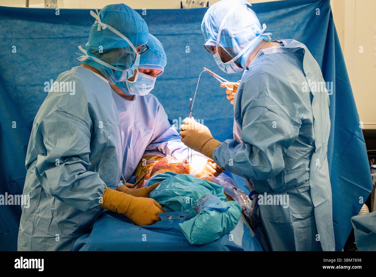 Placement of a hip prosthesis with robotic assistance at Lyon Sud ...