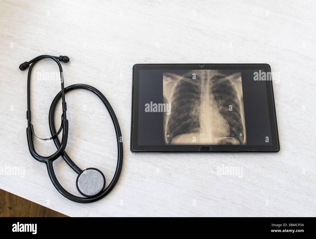 Table with phonendoscope, and a X ray image of the lungs with pneumonia ...