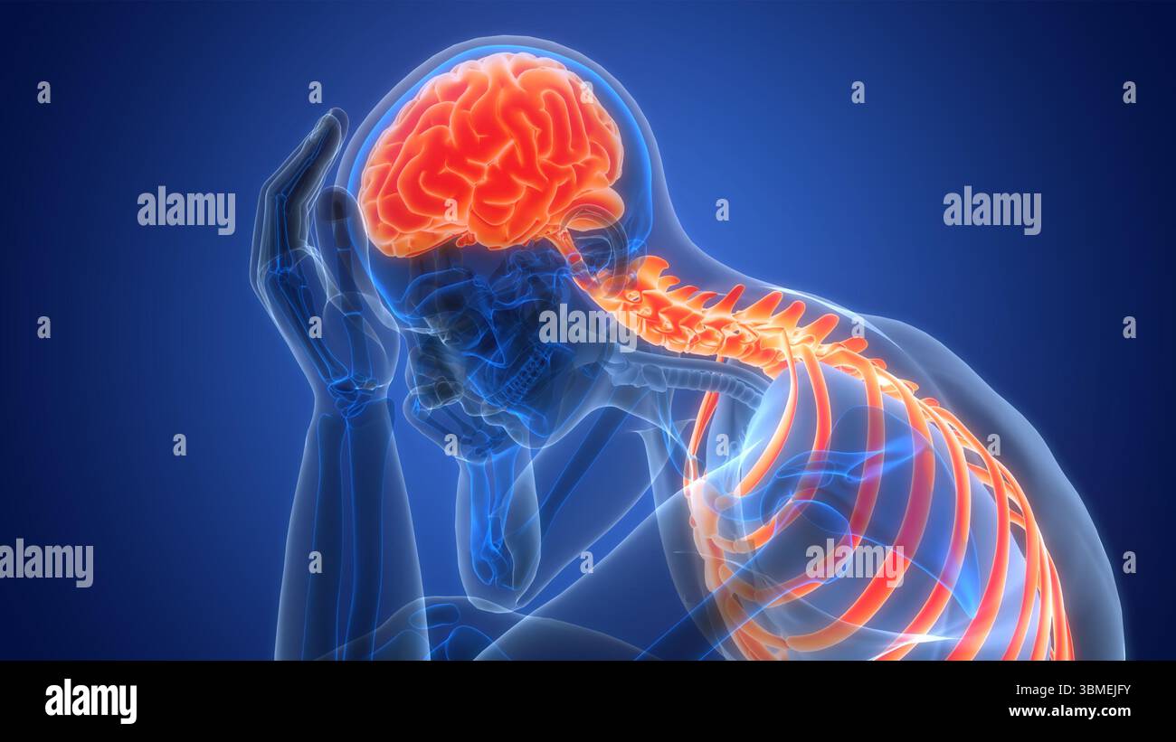 Human Suffering with Severe Headache Anatomy Stock Photo - Alamy