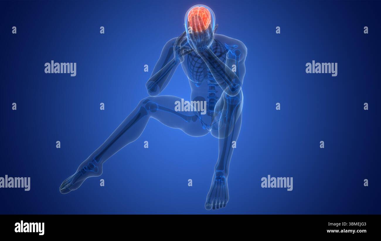 Human Suffering with Severe Headache Anatomy Stock Photo - Alamy