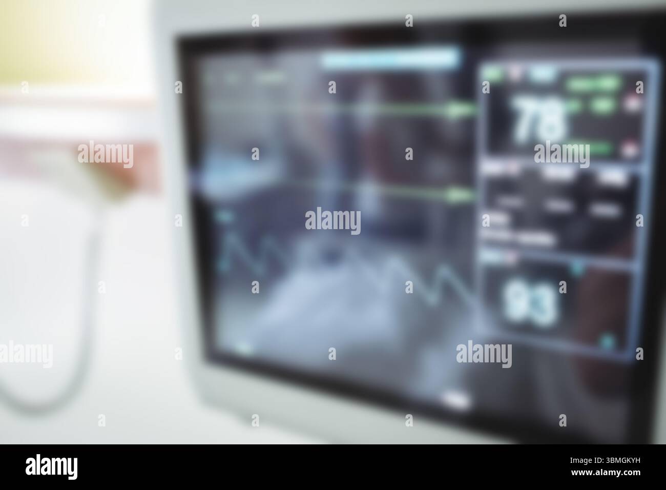 Ecg monitor in operation room hi-res stock photography and images - Alamy