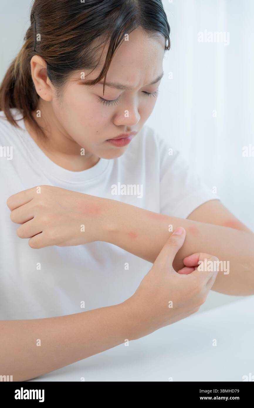 Skin and beauty problems Women have itchy skin and red rashes from ...