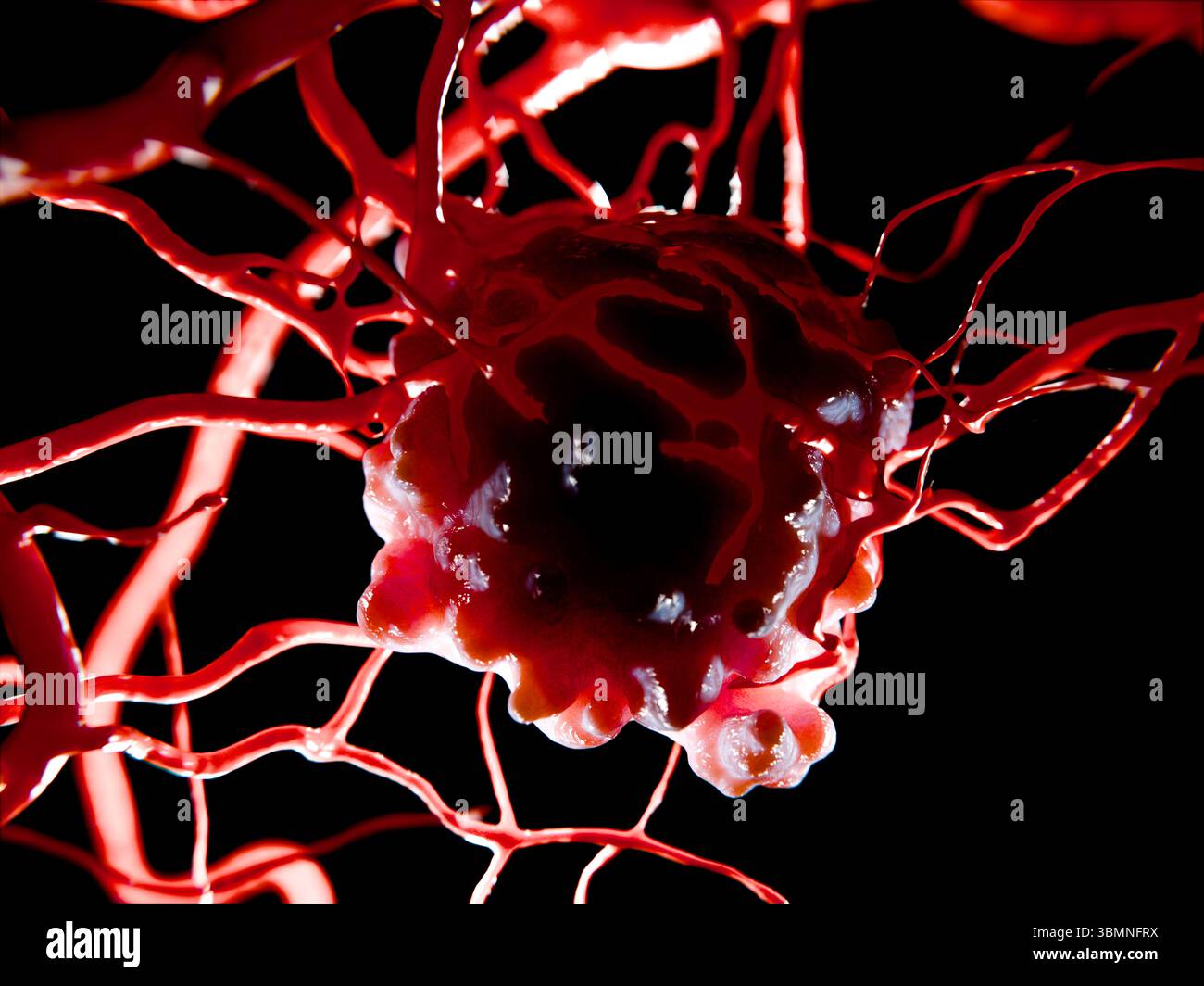 Blood vessel formation in a tumour. Illustration showing a malignant ...