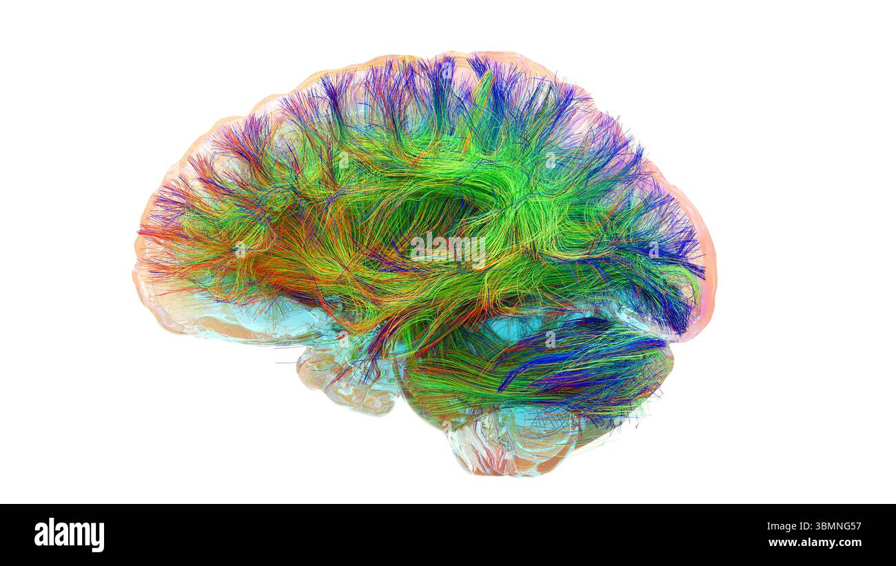 Illustration of a high-resolution brain tractogram, depicting the ...