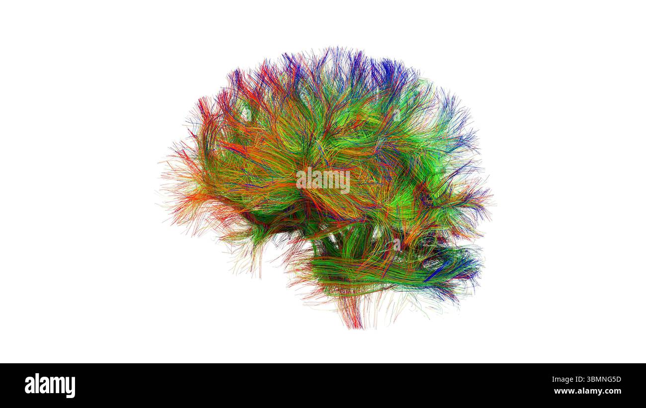 Illustration of a high-resolution brain tractogram, depicting the ...