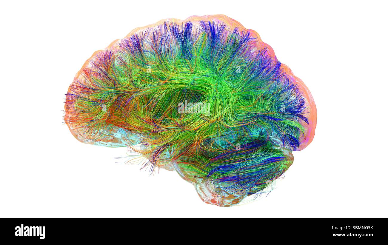 Illustration of a high-resolution brain tractogram, depicting the ...