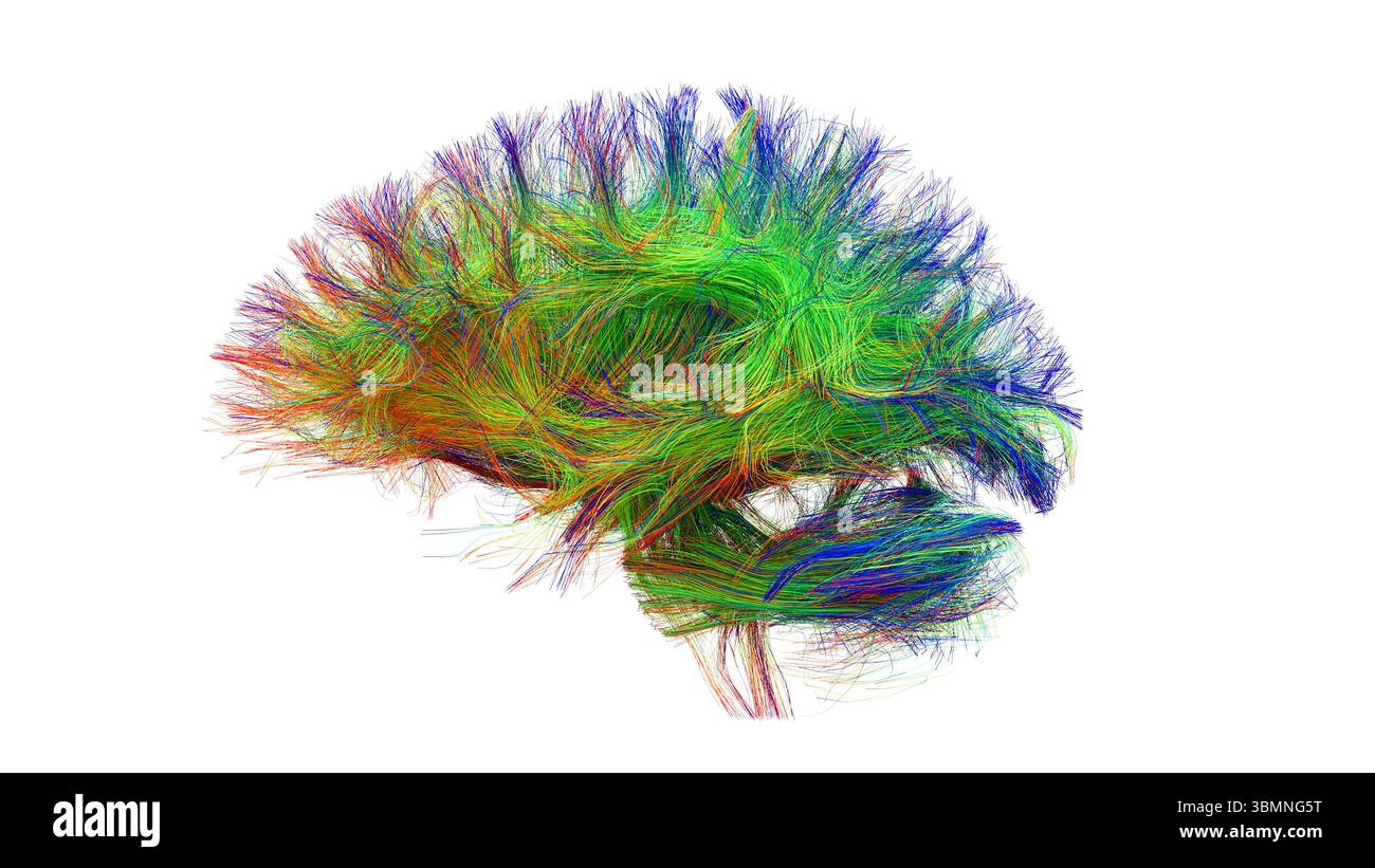 Illustration of a high-resolution brain tractogram, depicting the ...