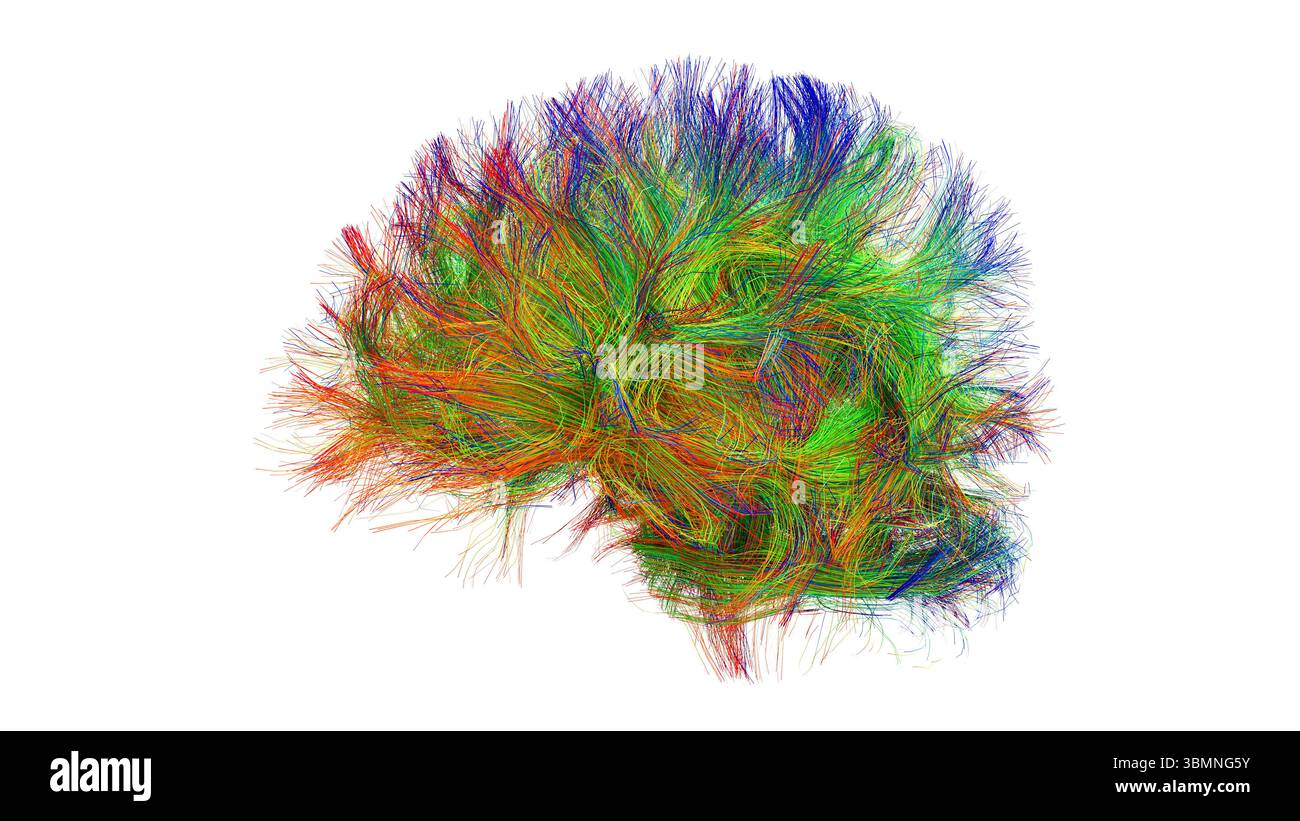 Illustration of a high-resolution brain tractogram, depicting the ...