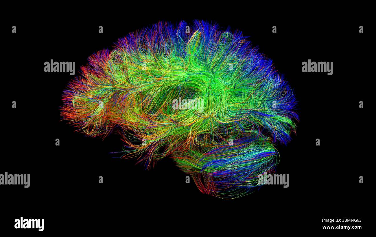 Illustration of a high-resolution brain tractogram, depicting the ...