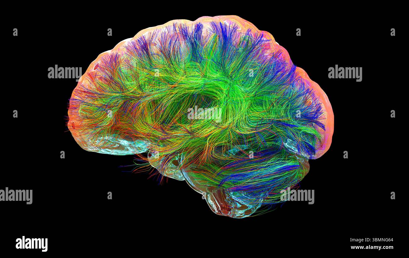 Illustration of a high-resolution brain tractogram, depicting the ...