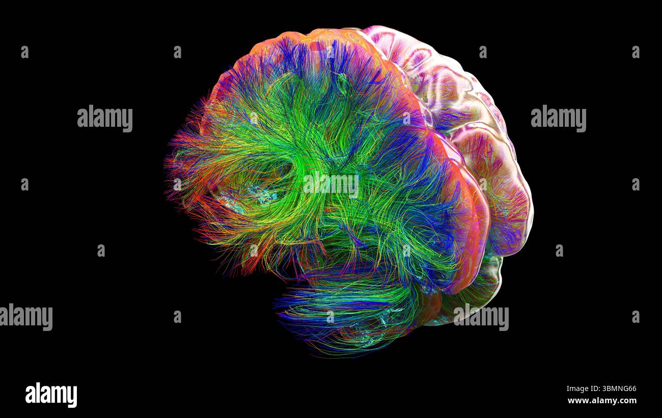 Illustration of a high-resolution brain tractogram, depicting the ...