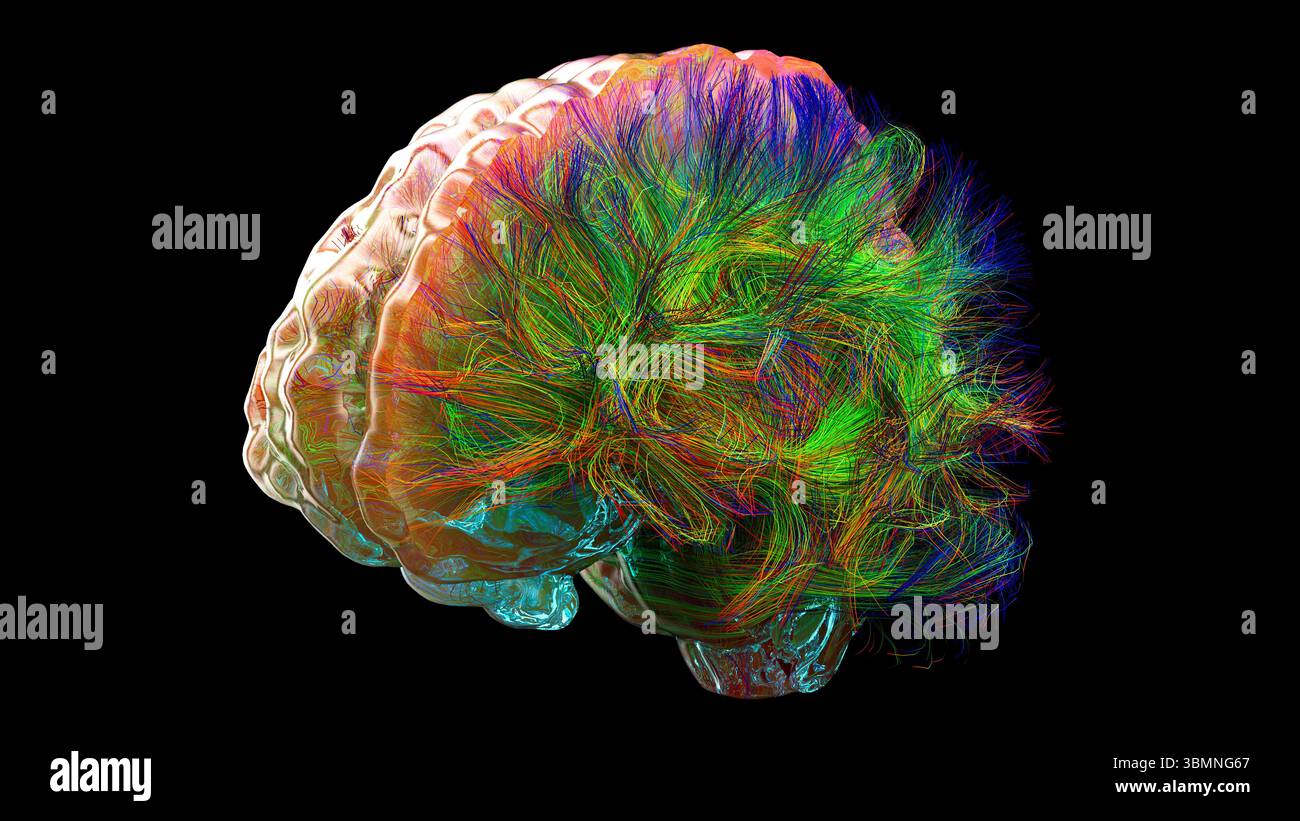 Illustration of a high-resolution brain tractogram, depicting the ...