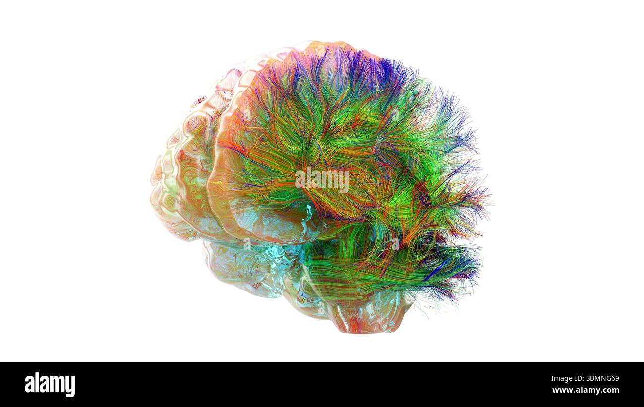Illustration of a high-resolution brain tractogram, depicting the ...