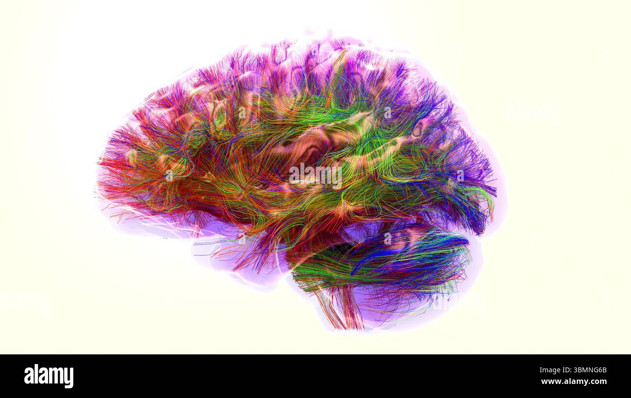 Illustration of a high-resolution brain tractogram, depicting the ...