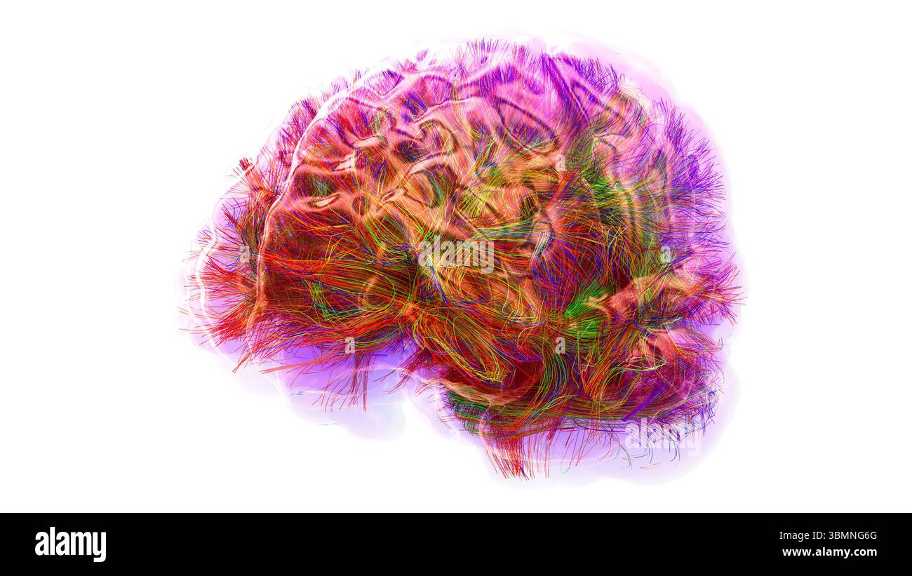 Illustration of a high-resolution brain tractogram, depicting the ...