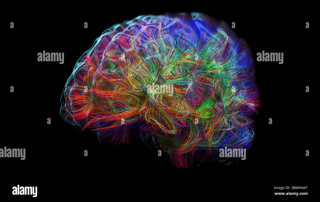 Illustration of a high-resolution brain tractogram, depicting the ...