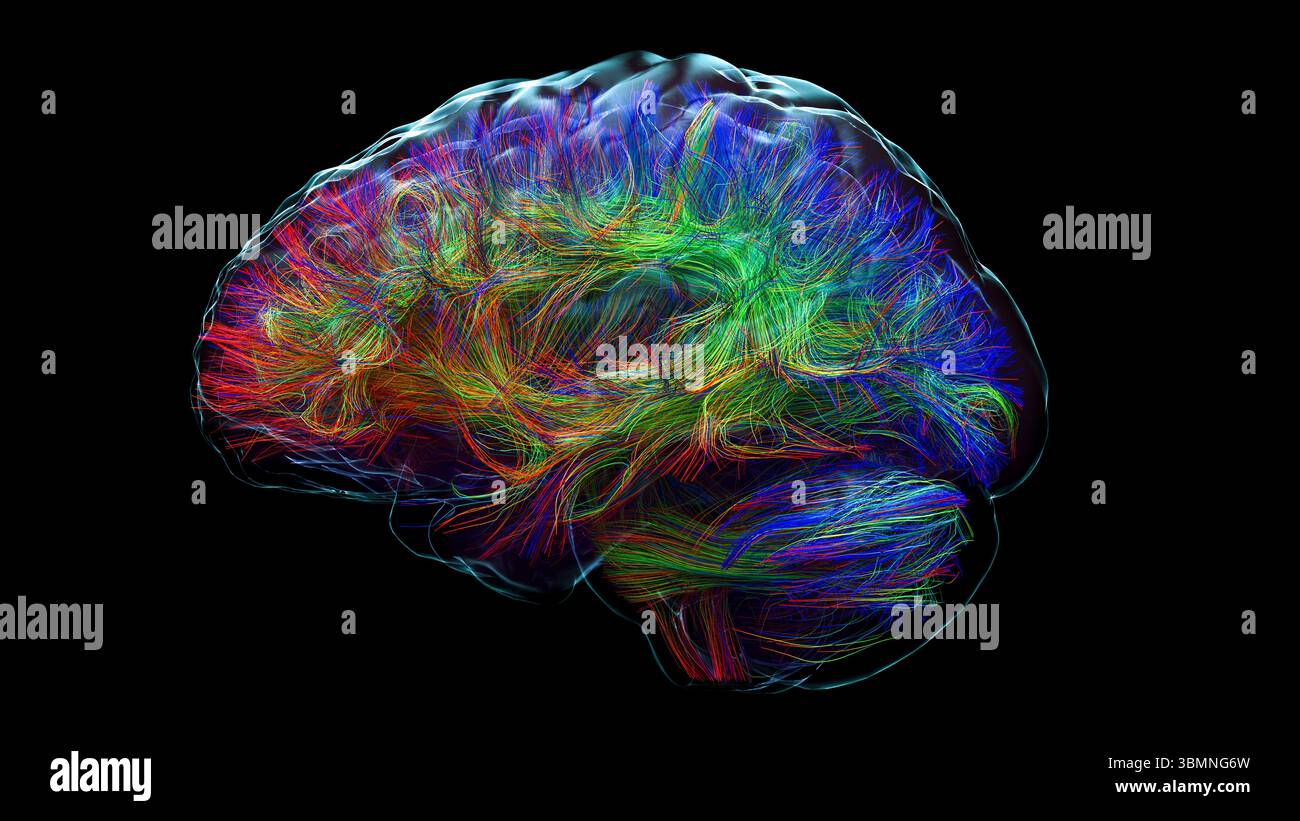 Illustration of a high-resolution brain tractogram, depicting the ...