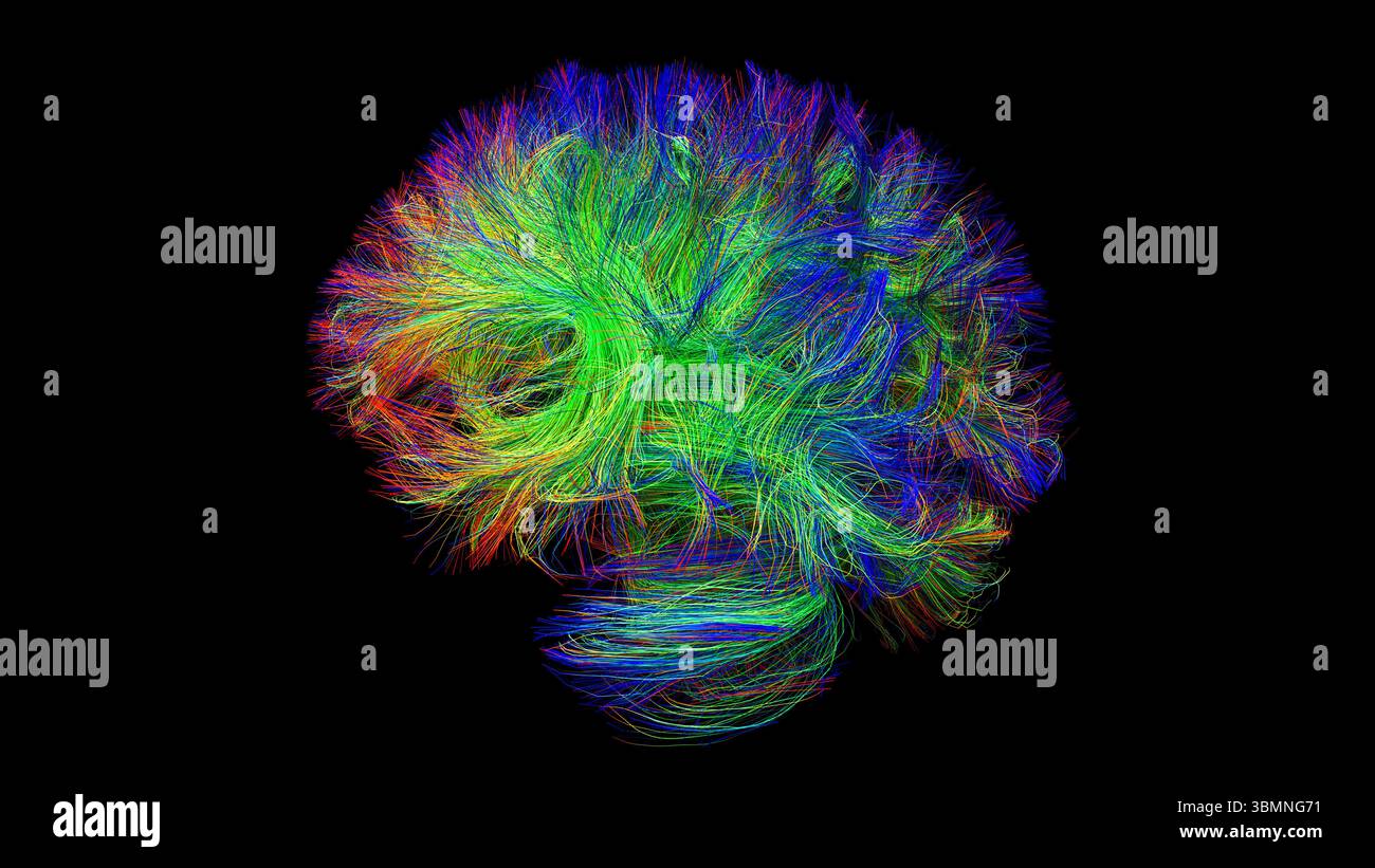 Illustration of a high-resolution brain tractogram, depicting the ...