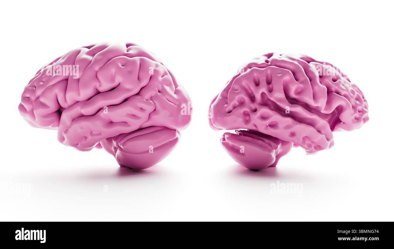 Illustration comparing a healthy brain (left) and one affected by ...