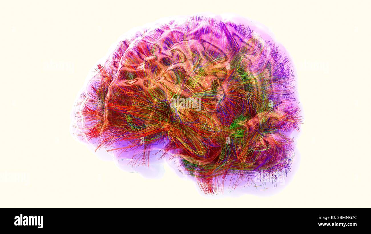 Illustration of a high-resolution brain tractogram, depicting the ...