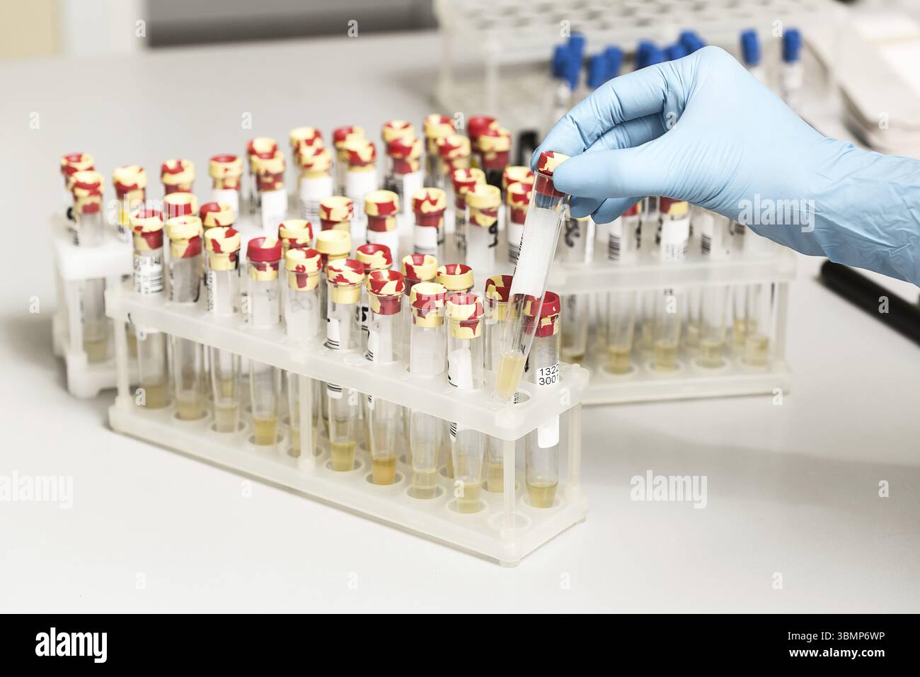 A chemical sample bottle. Centrifuge. A test tube vial sets for ...