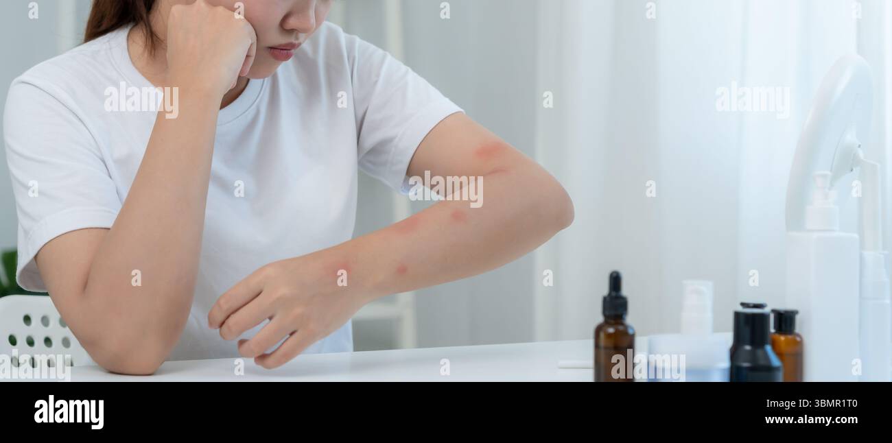 Skin and beauty problems Women have itchy skin and red rashes from ...