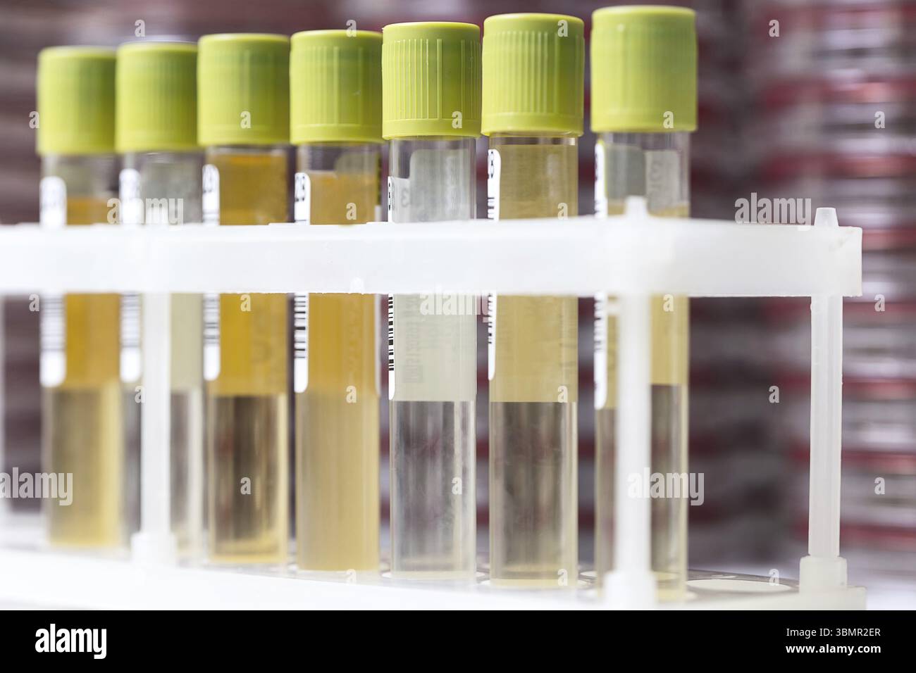 Test-tubes with yellow liquid in the laboratory. Medical research Stock ...