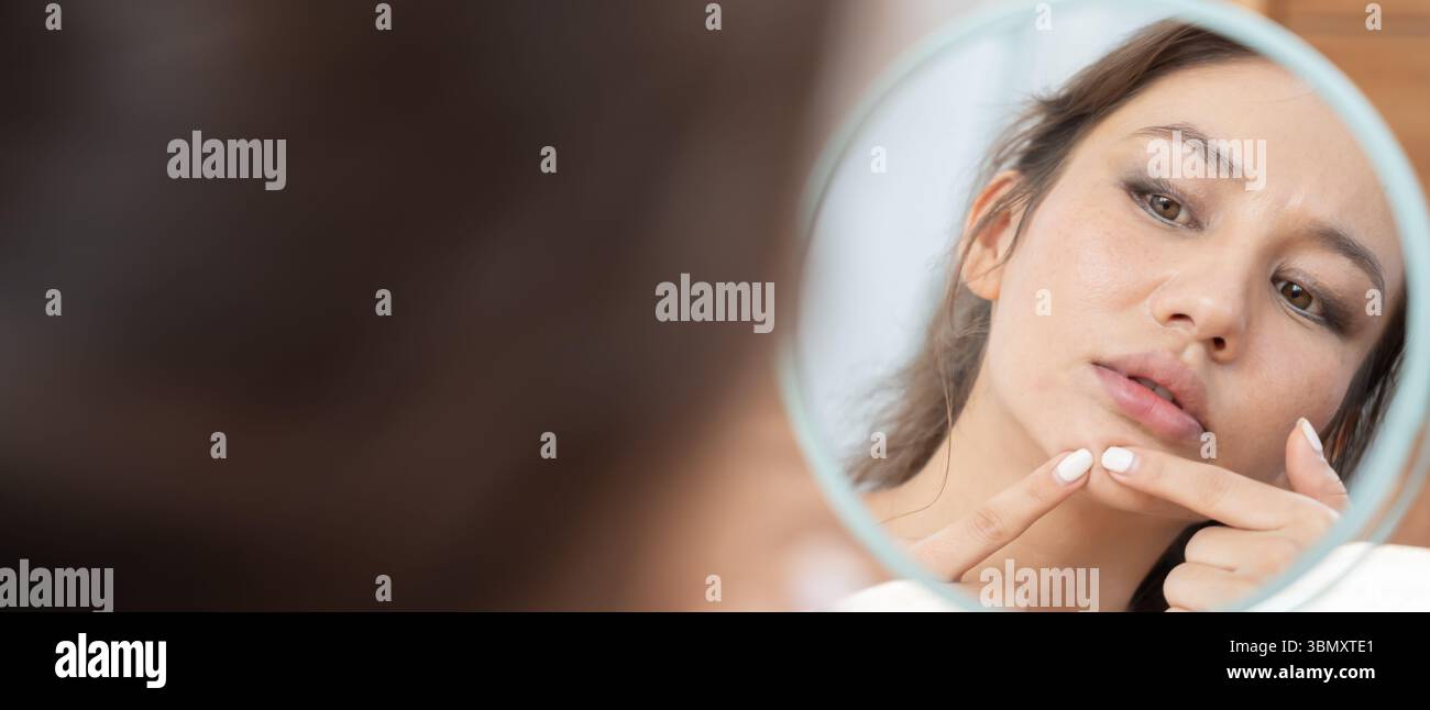 Woman worried about face Dermatology, rosacea dermatitis, allergic ...