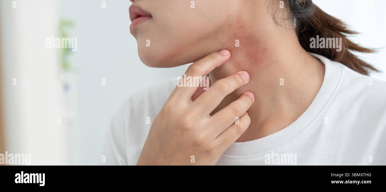 Skin and beauty problems Women have itchy skin and red rashes from ...