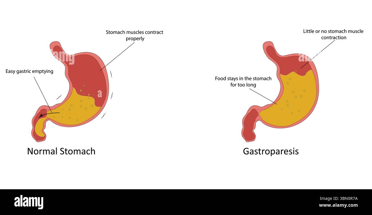 Healthcare nausea Cut Out Stock Images & Pictures - Alamy