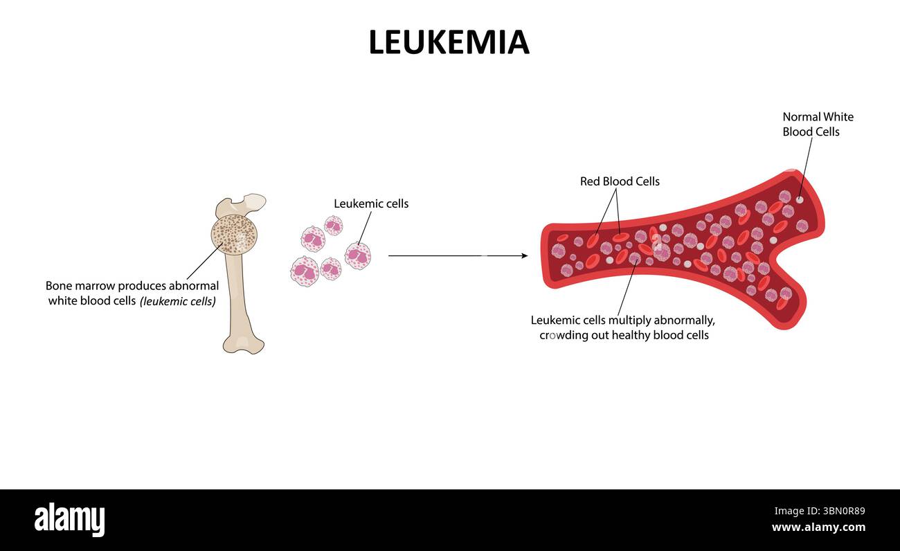 Wbc vector Stock Vector Images - Alamy