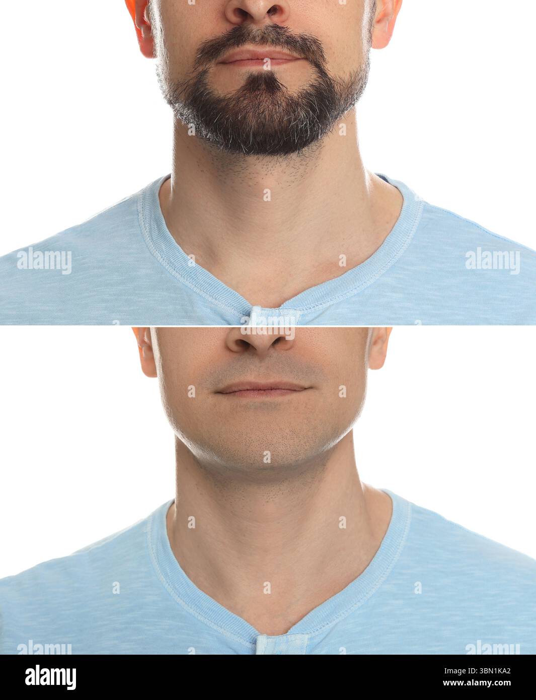 Man before and after shaving on white background, closeup. Collage of ...