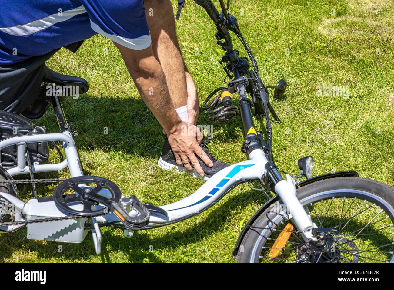 Cyclist with a broken leg and sprained ankle after an electric bike ...