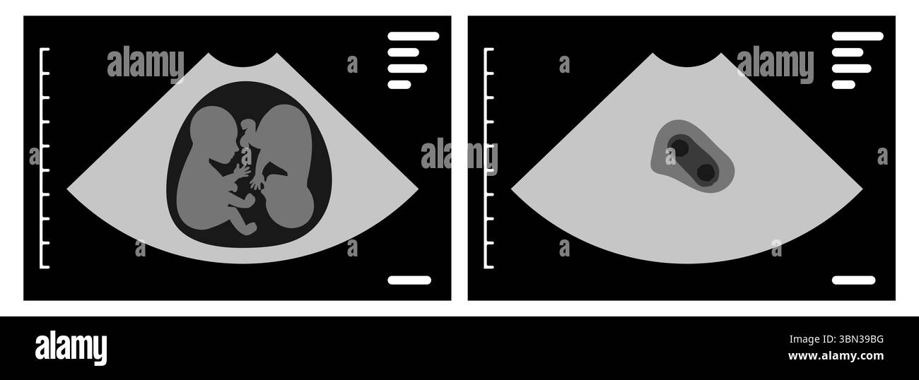 Ultrasound scan utero baby Cut Out Stock Images & Pictures - Alamy