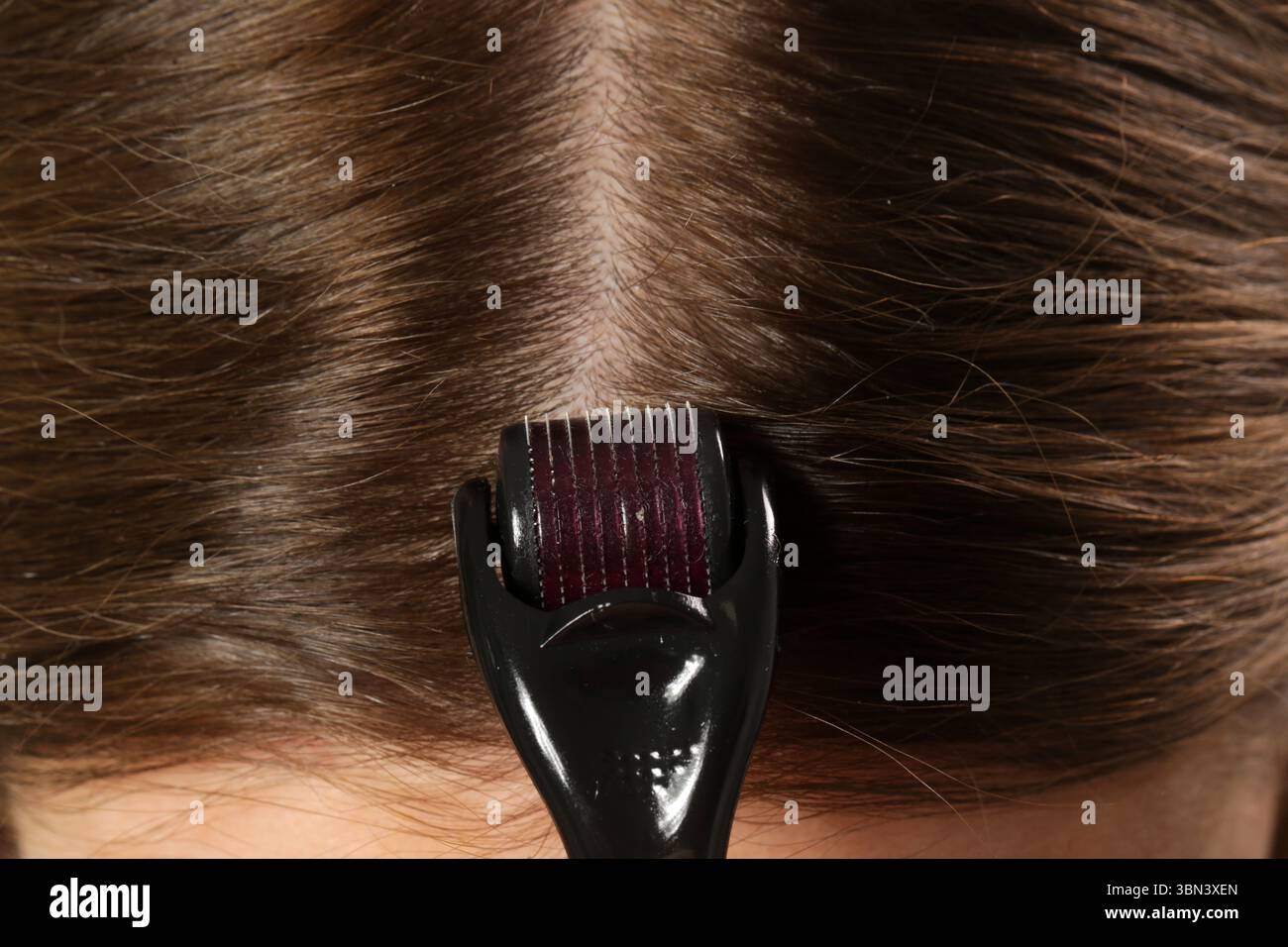 Needle mesotherapy scalp microneedle hi-res stock photography and ...