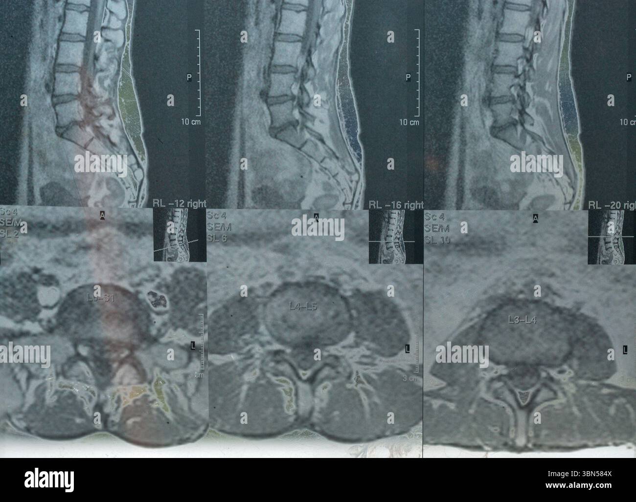 Computed tomography image scan hi-res stock photography and images - Alamy