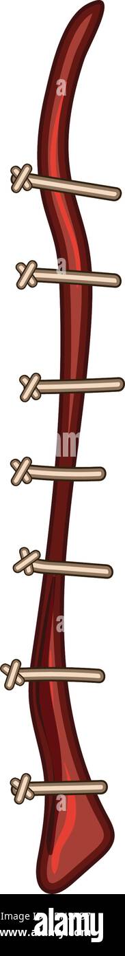 healing suture cartoon vector illustration Stock Vector Image & Art - Alamy