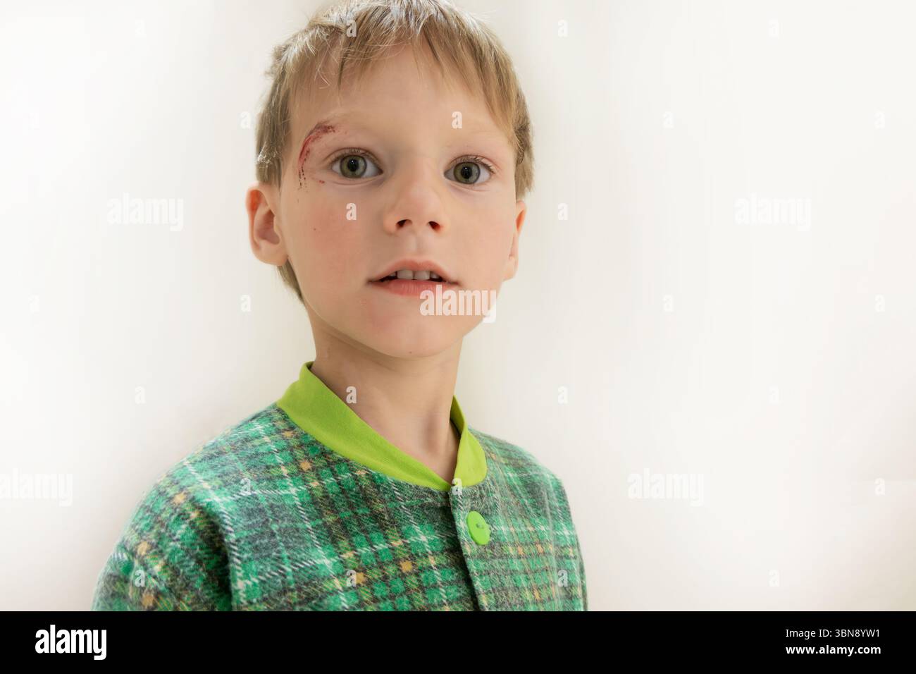 boy with a head wound Stock Photo - Alamy