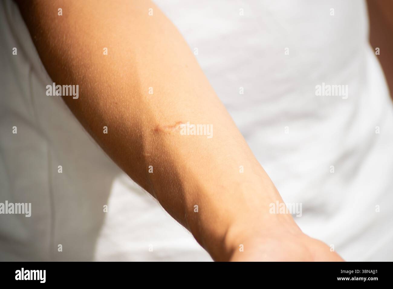 Showcasing visible damage hi-res stock photography and images - Alamy