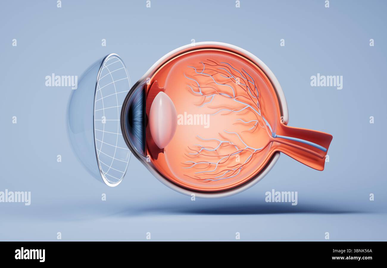 Medical eyeball structure and contact lens, 3d rendering. 3D ...