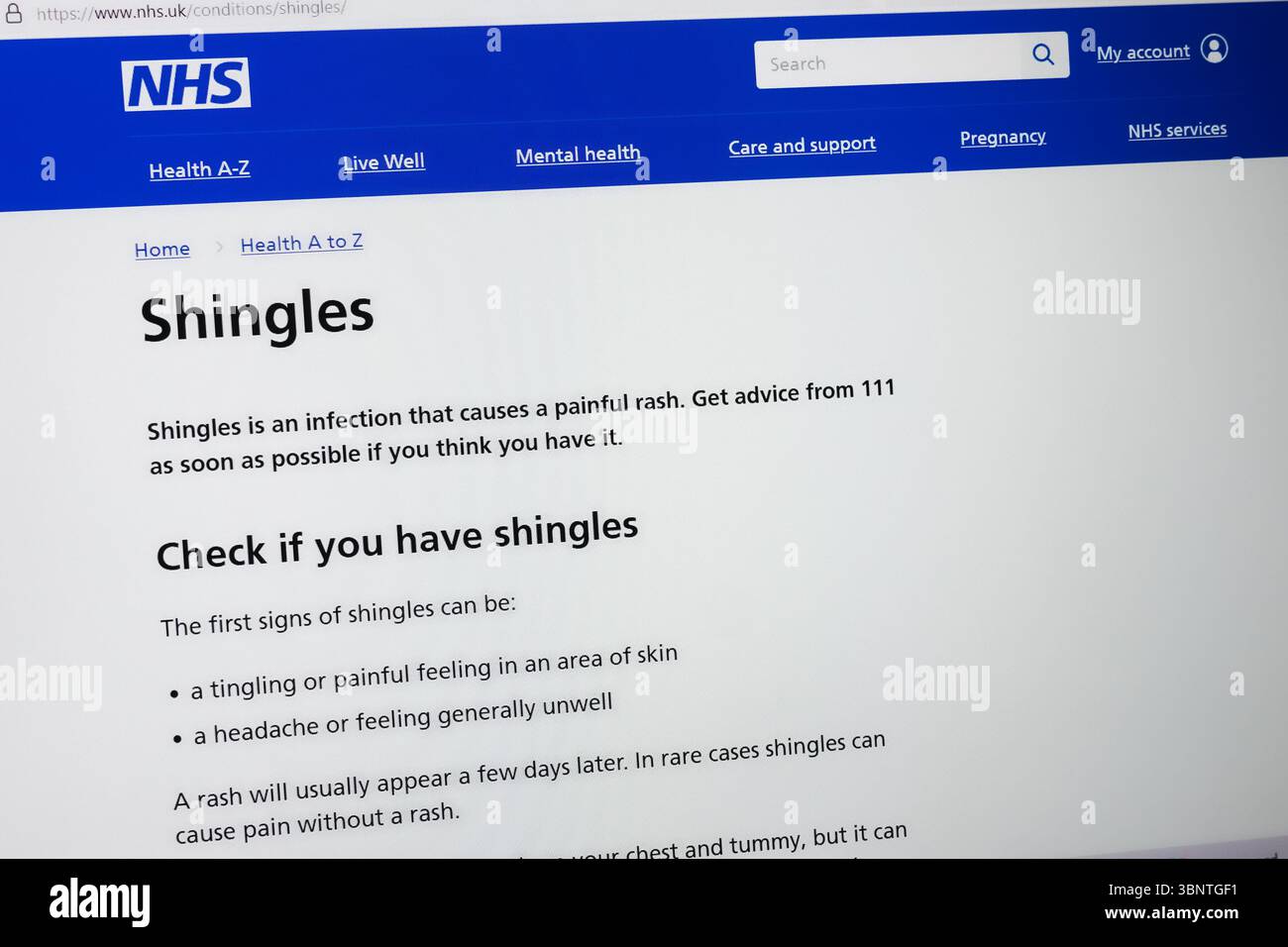 The NHS website with information about shingles Stock Photo - Alamy
