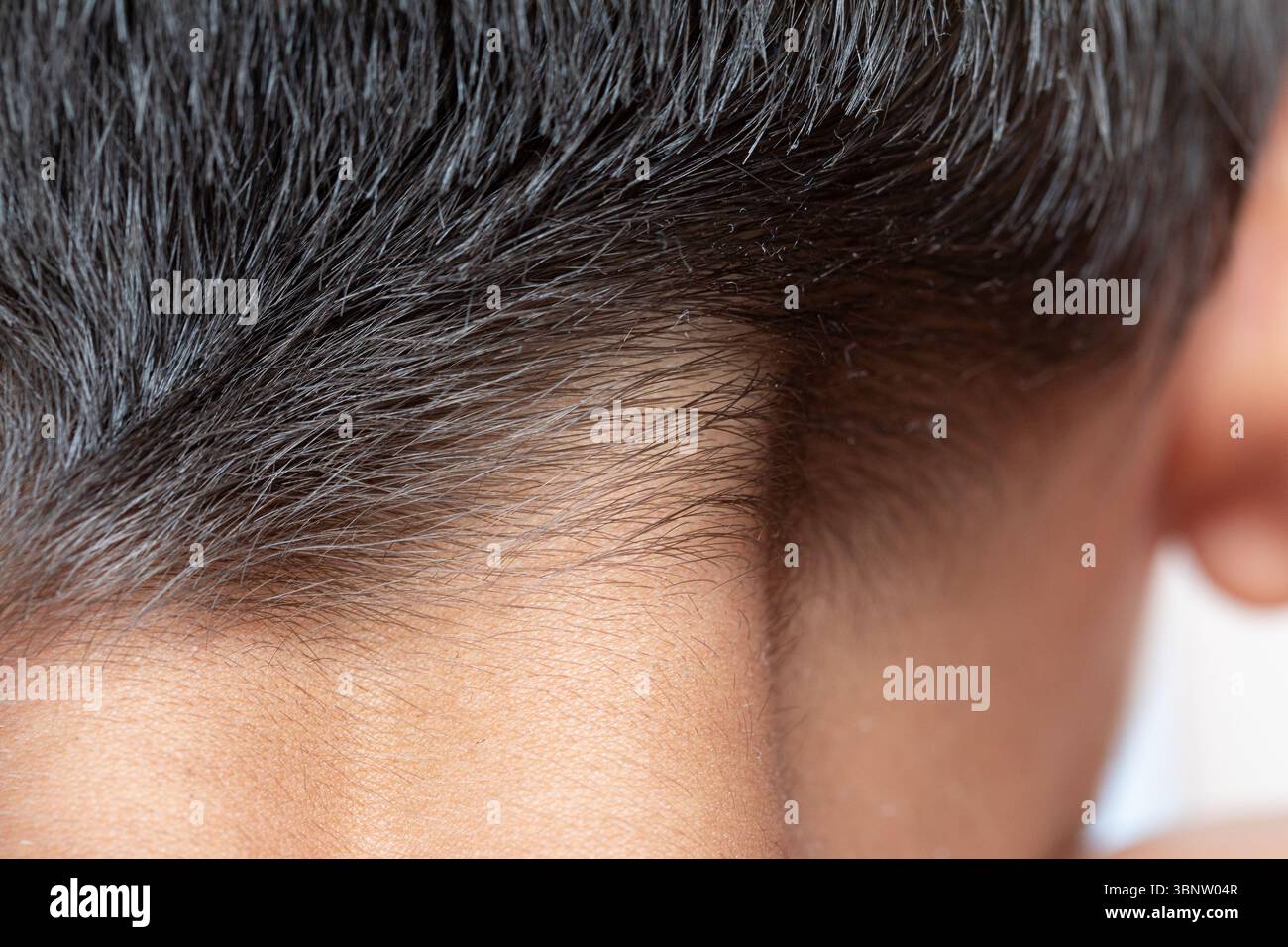 Detailed view of healthy hair and scalp on the back of a head ...